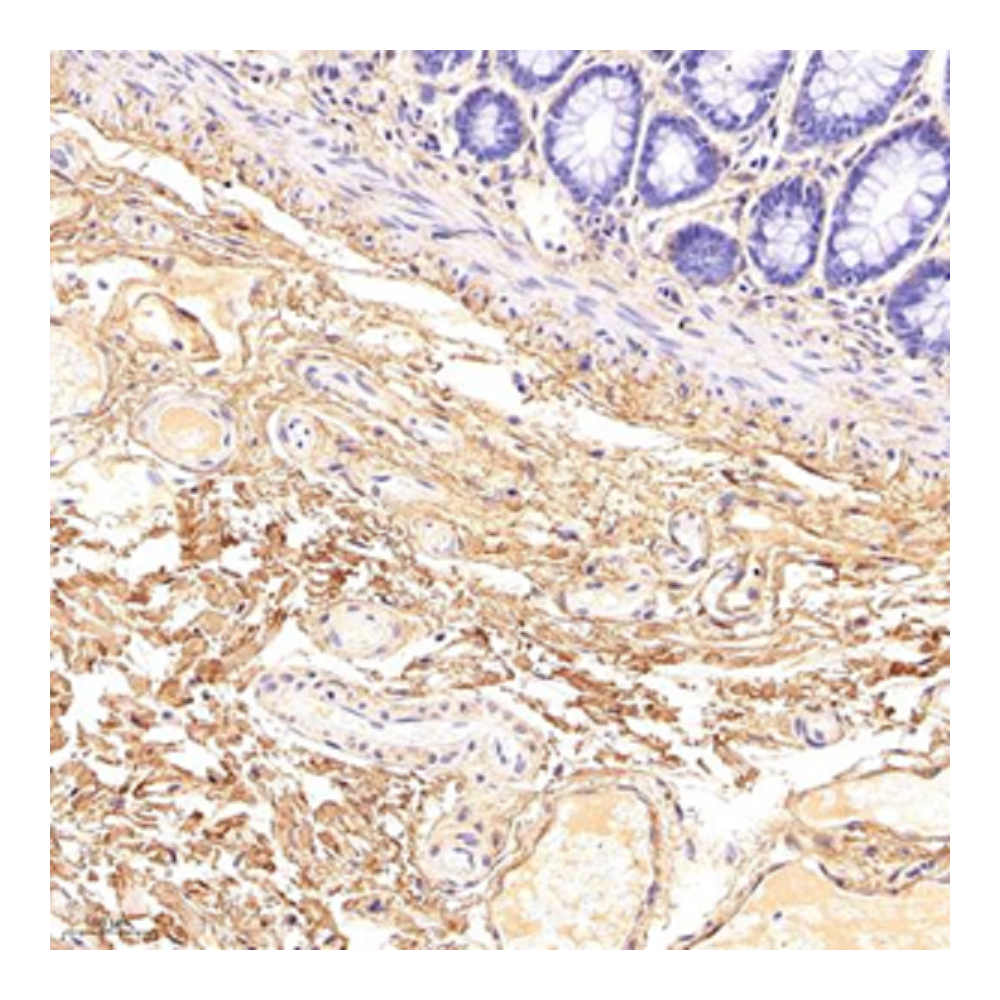 Anti-Collagen I Rabbit pAb, Primary Antibody