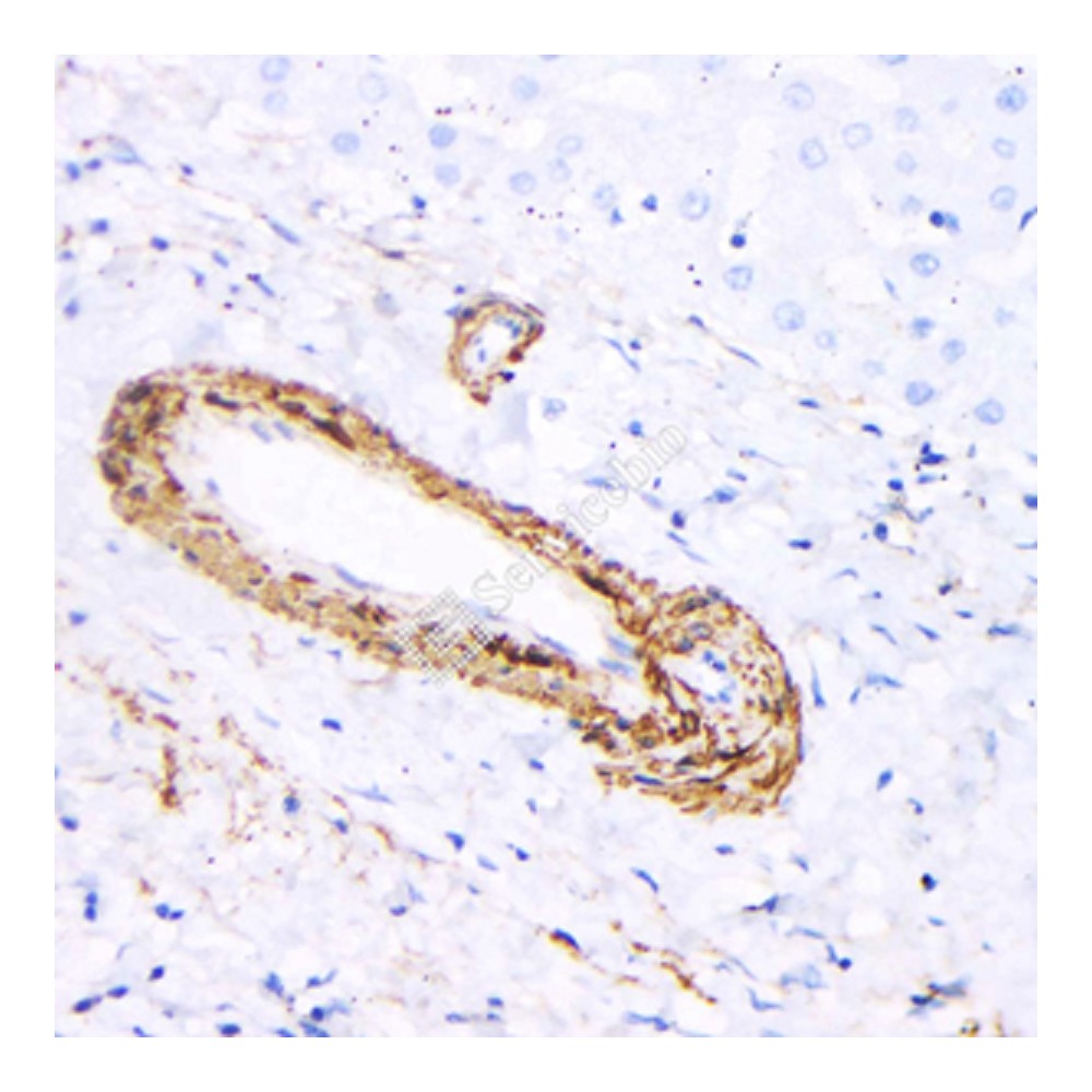Anti-alpha smooth muscle Actin Mouse mAb, Primary Antibody